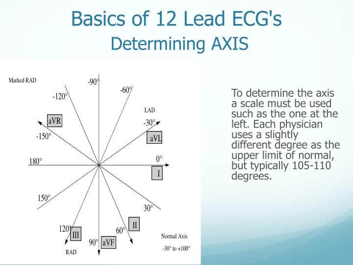 PPT - Determining AXIS : 12 Lead ECG's PowerPoint Presentation - ID:2568340