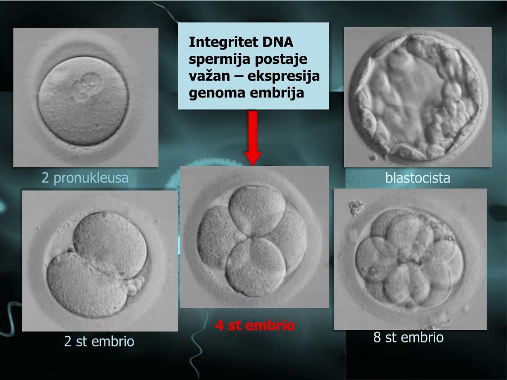PPT - Utjecaj DNA fragmentacije na ishod IVF/ICSI PowerPoint ...