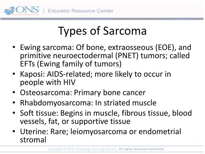PPT - Sarcoma PowerPoint Presentation - ID:2579867