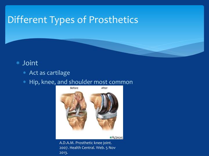 PPT - Information on Prosthetics PowerPoint Presentation - ID:2580015