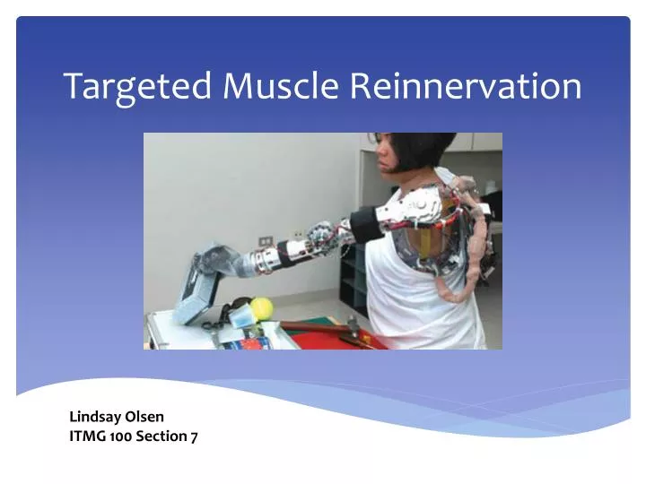PPT - Targeted Muscle Reinnervation PowerPoint Presentation, free ...