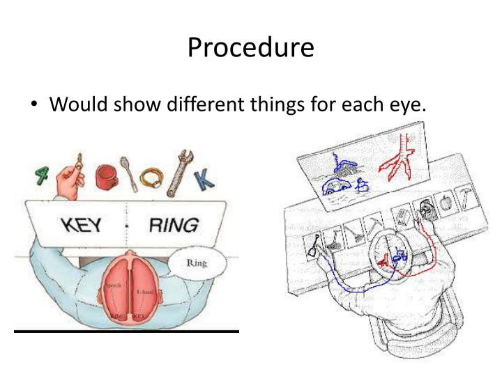 PPT - The split Brain PowerPoint Presentation - ID:2591366