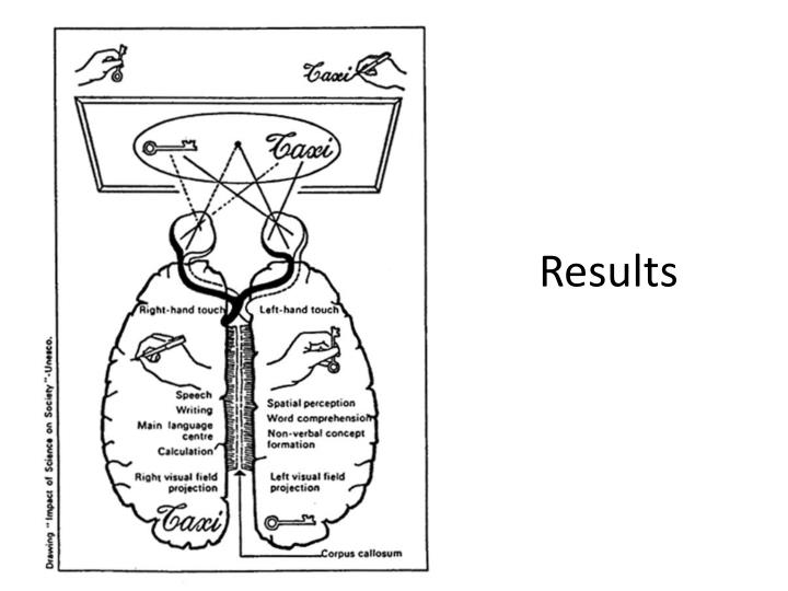 PPT - The split Brain PowerPoint Presentation - ID:2591366