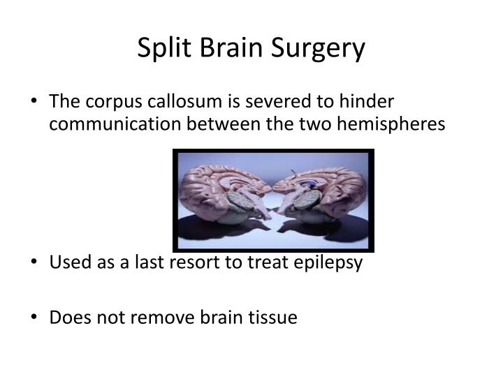 PPT - The split Brain PowerPoint Presentation - ID:2591366