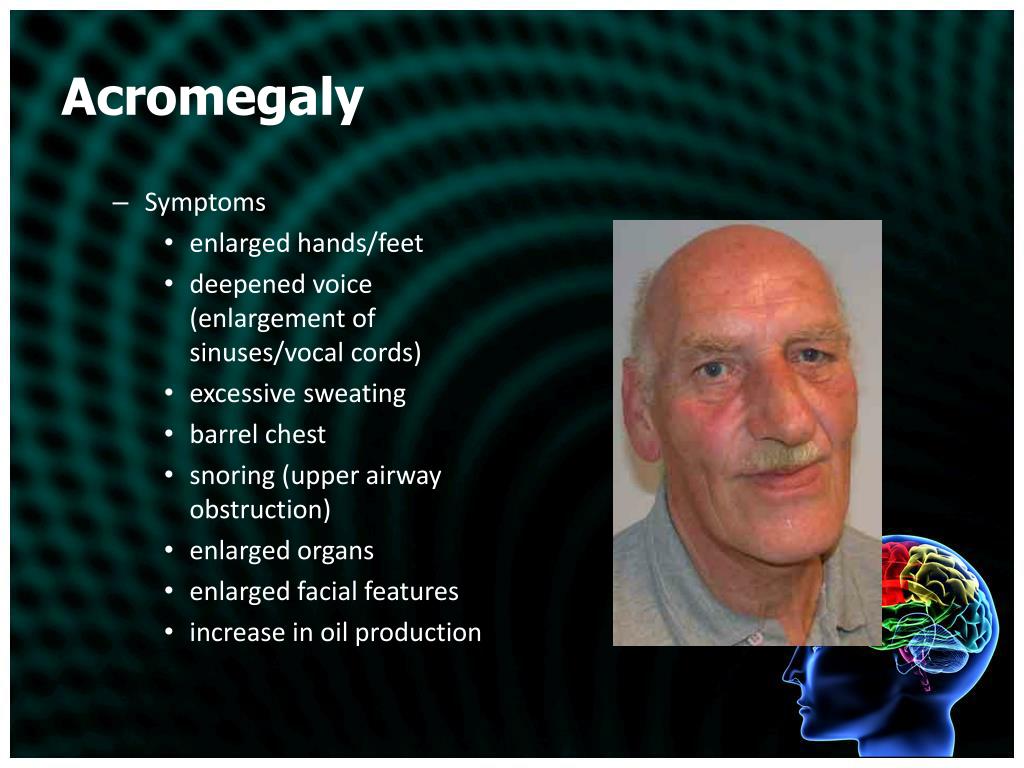 PPT - Pituitary Gland (Posterior & Anterior) PowerPoint Presentation ...