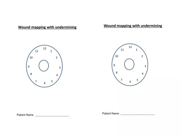 PPT - Wound mapping with undermining PowerPoint Presentation, free ...