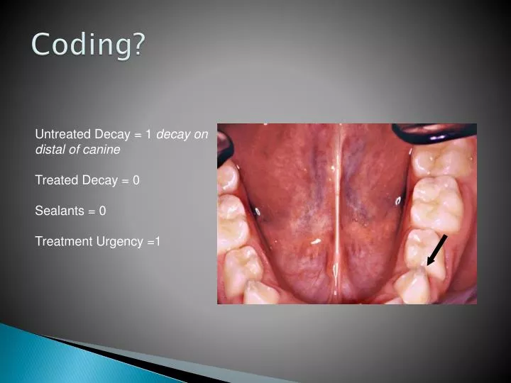 PPT - Coding? PowerPoint Presentation, free download - ID:2612131