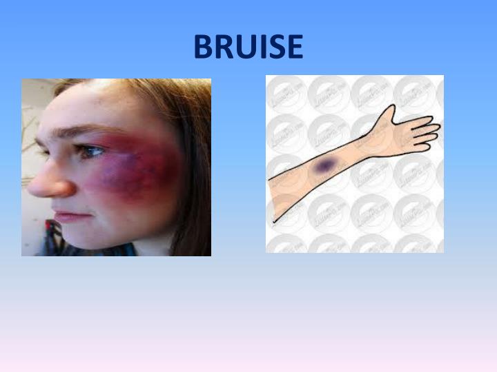 PPT - THE LITTLE BULLY PowerPoint Presentation - ID:2618704