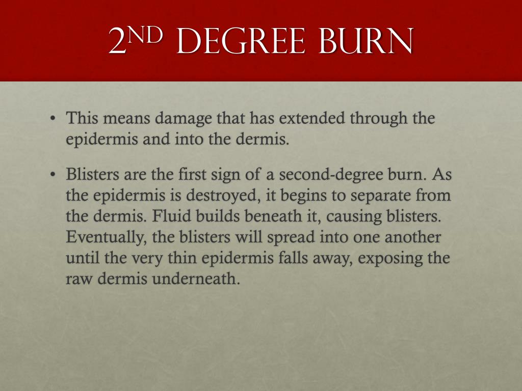 PPT - Understanding Skin Pigmentation and Burn Degrees: A Comprehensive ...