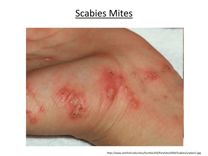 PPT - Microscopy PowerPoint Presentation - ID:2620783
