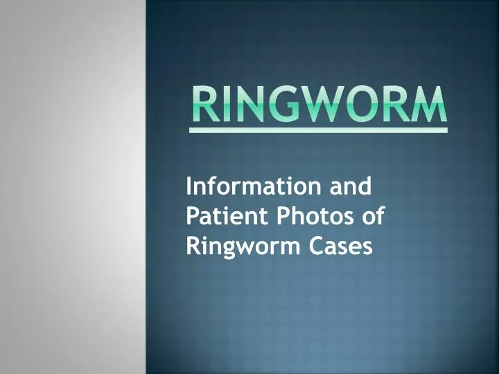PPT - Ringworm PowerPoint Presentation, free download - ID:2634085
