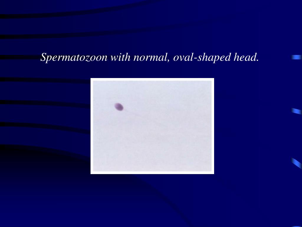 Ppt Semen Analysis Powerpoint Presentation Free Download Id 2641105