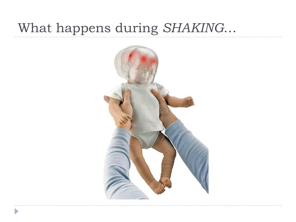 PPT - Shaken Baby Syndrome Prevention PowerPoint Presentation, free ...