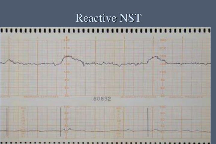 PPT - Fetal Heart Rate Monitoring PowerPoint Presentation - ID:2646802
