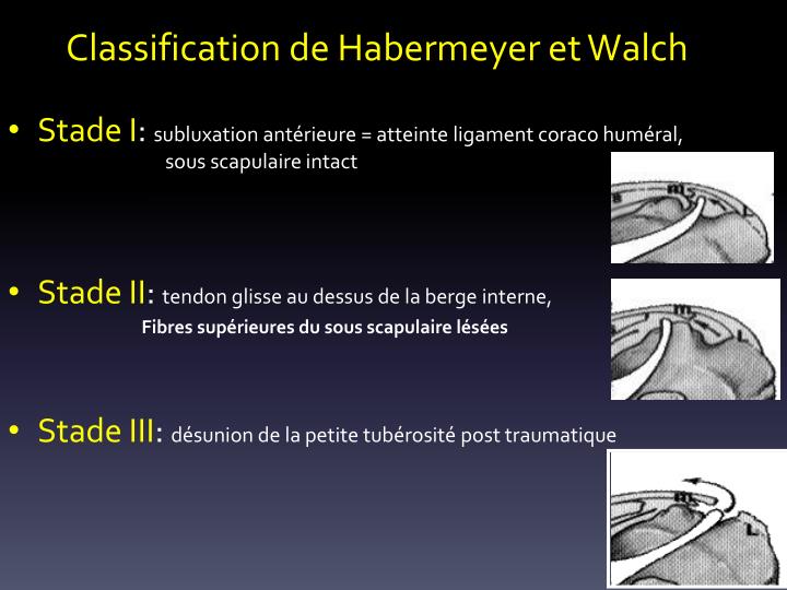 PPT - Pathologie Micro-traumatique de l'Epaule PowerPoint Presentation ...