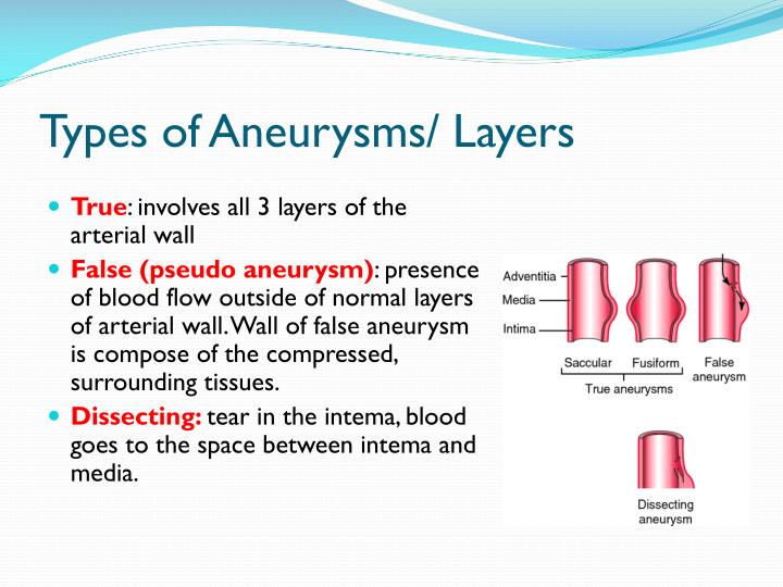 PPT - Acute arterial disorders PowerPoint Presentation - ID:2648454