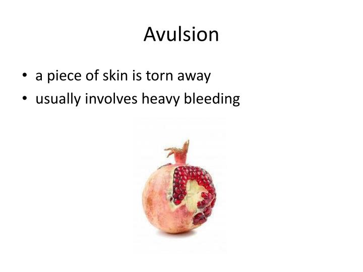 PPT - Health Unit #2: First Aid PowerPoint Presentation - ID:2658254