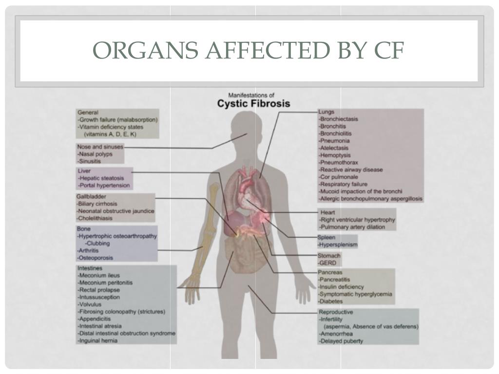 PPT - Cystic Fibrosis: A Clinical Nutrition Case STudy PowerPoint ...