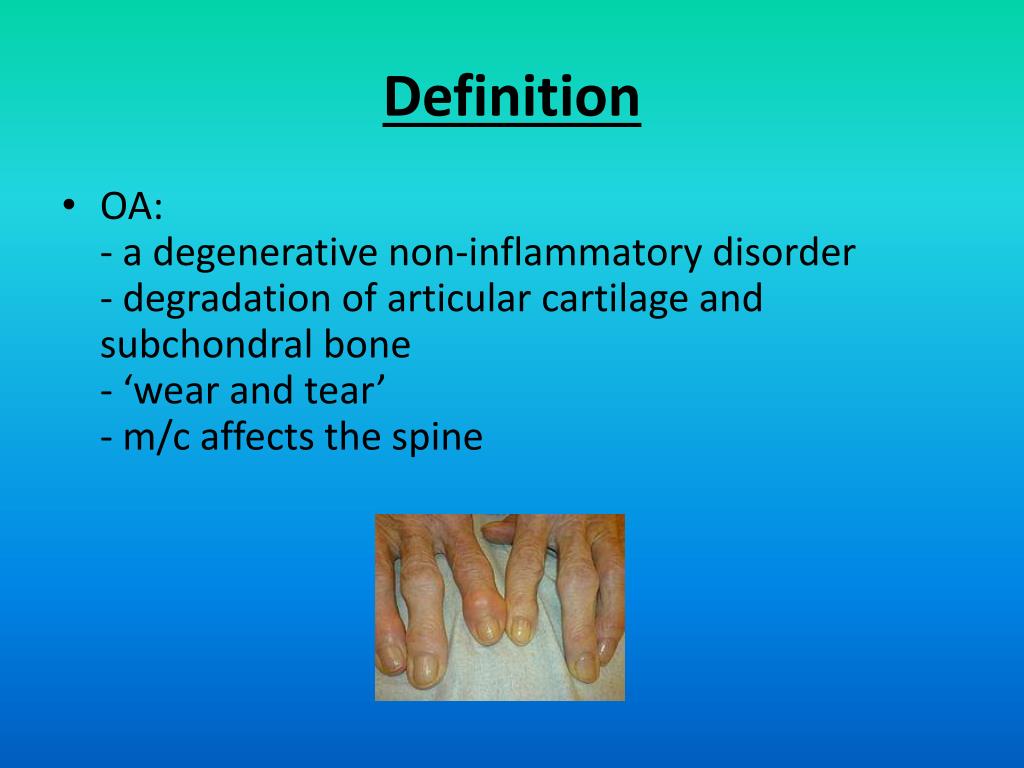 PPT - Rheumatoid Arthritis and Osteoarthritis PowerPoint Presentation ...