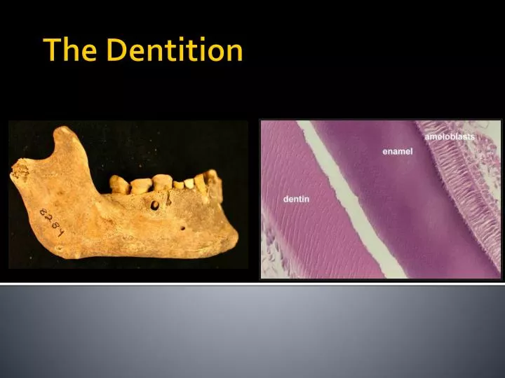 PPT - The Dentition PowerPoint Presentation, free download - ID:2665297