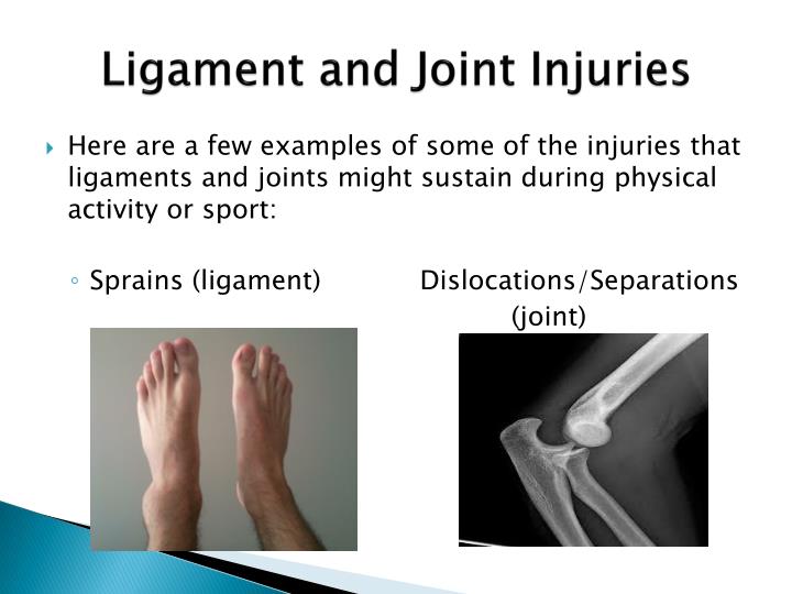 PPT - Sports Injuries and Prevention PowerPoint Presentation - ID:2669912