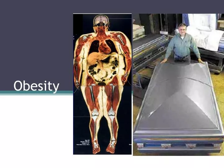PPT - Obesity PowerPoint Presentation, free download - ID:2670823