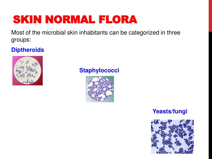 PPT - Normal Flora PowerPoint Presentation - ID:2674250
