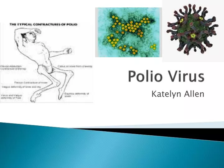 PPT - Polio Virus PowerPoint Presentation, free download - ID:2675702