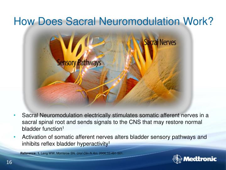 PPT - Sacral Neuromodulation PowerPoint Presentation - ID:2675769