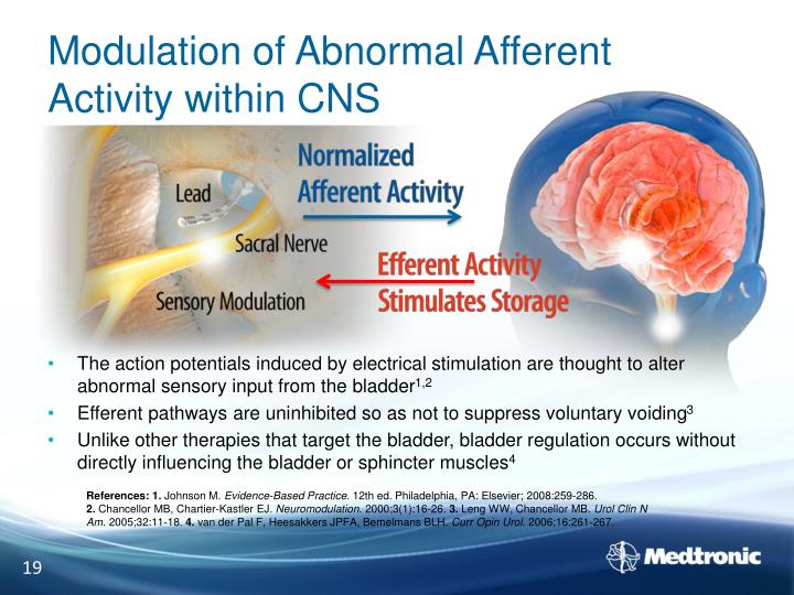 PPT - Sacral Neuromodulation PowerPoint Presentation - ID:2675769