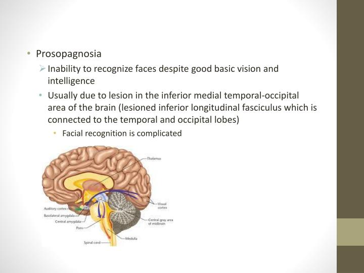 PPT - Agnosia PowerPoint Presentation - ID:2678587