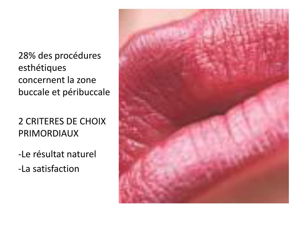 PPT - VIEILLISSEMENT ET TRAITEMENT DE LA ZONE BUCCALE ET PERIBUCCALE ...