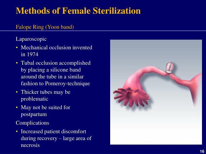 PPT - FEMALE STERILISATION PowerPoint Presentation - ID:2682917