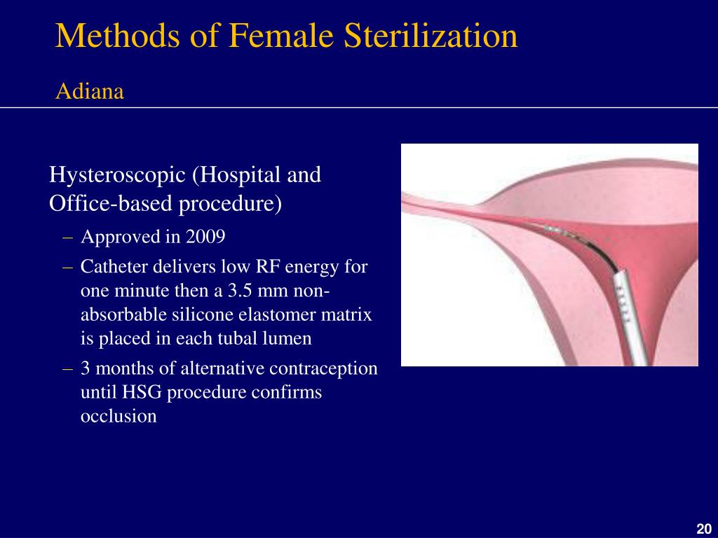 Ppt Female Sterilisation Powerpoint Presentation Free Download Id