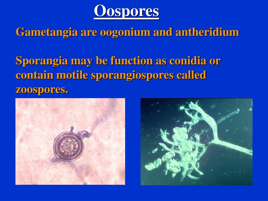 PPT - Diseases Caused by Fungi (Including disease by ‘lower fungi ...