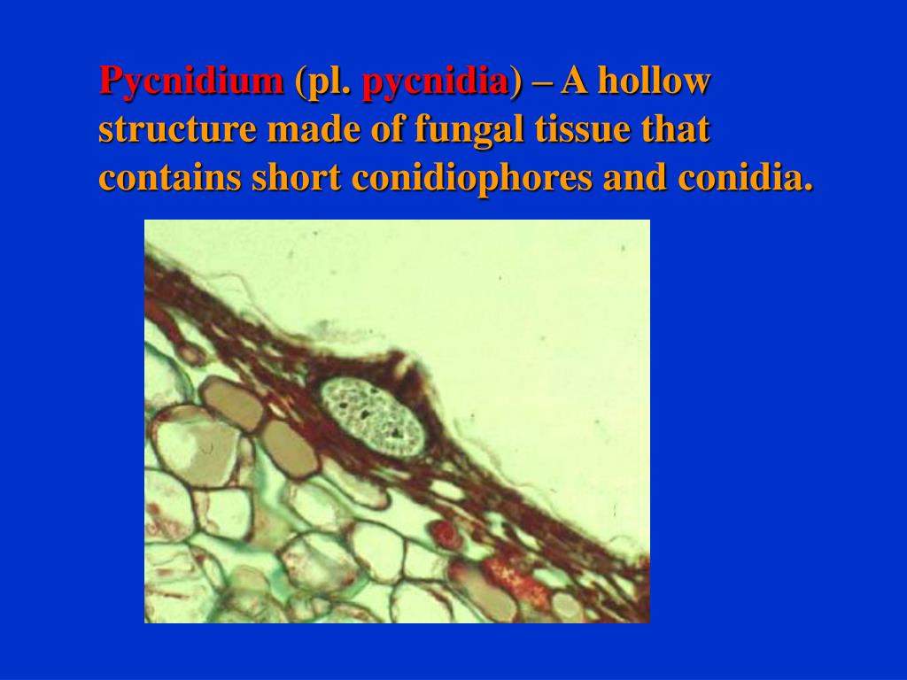 PPT - Diseases Caused by Fungi (Including disease by ‘lower fungi ...