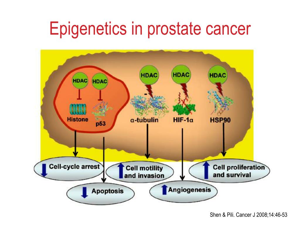 PPT - The physiopathological evolution of prostate cancer Antonello Di ...