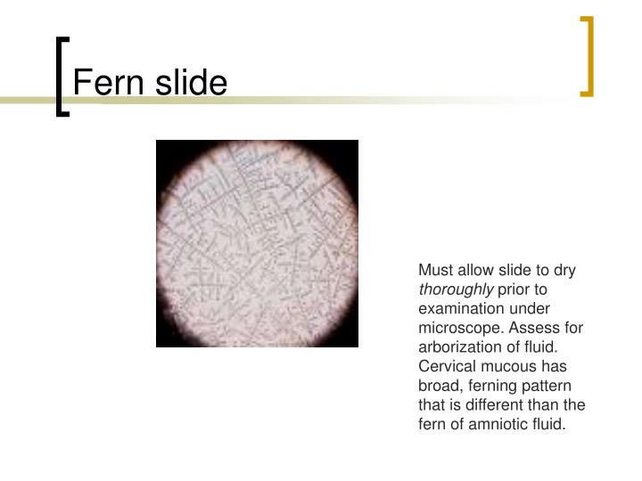 PPT - Preterm Rupture of Membranes PowerPoint Presentation - ID:2686700