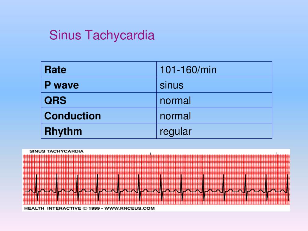 PPT - Cardiopumonary Arrest PowerPoint Presentation, free download - ID ...