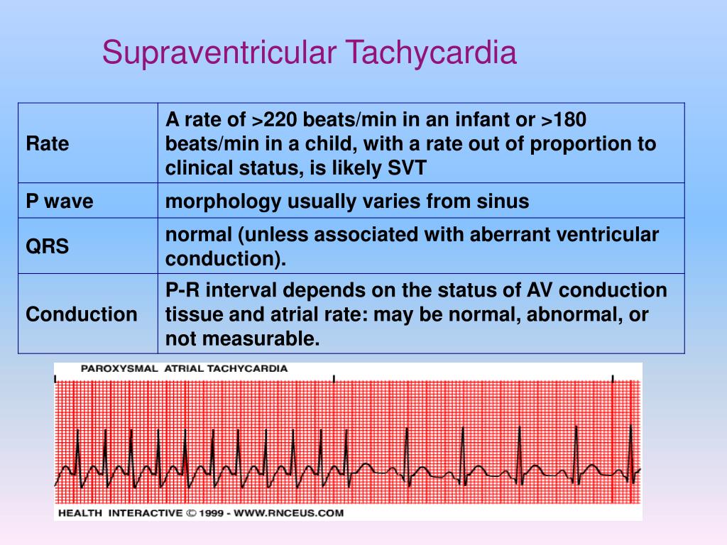 PPT - Cardiopumonary Arrest PowerPoint Presentation, free download - ID ...