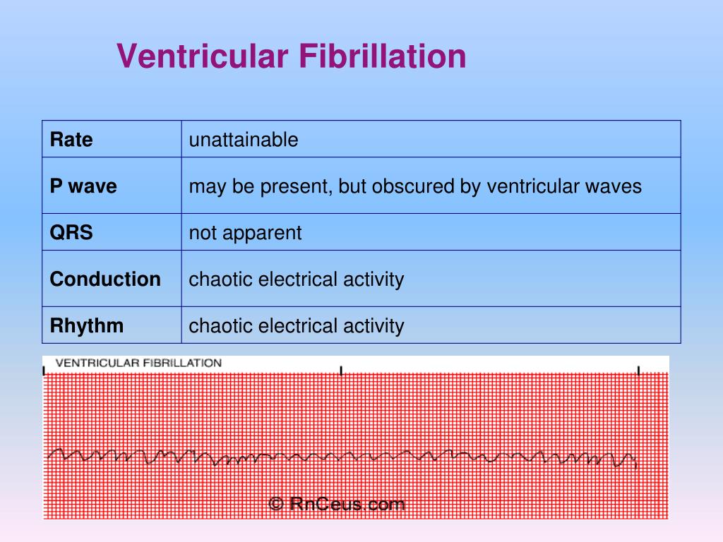 PPT - Cardiopumonary Arrest PowerPoint Presentation, free download - ID ...