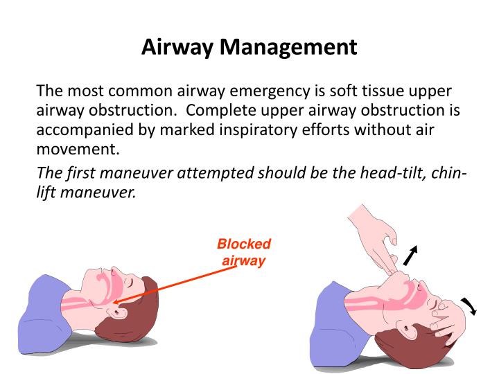 PPT - Respiratory (A&P, ABG’s, Assessment) Respiratory case studies ...