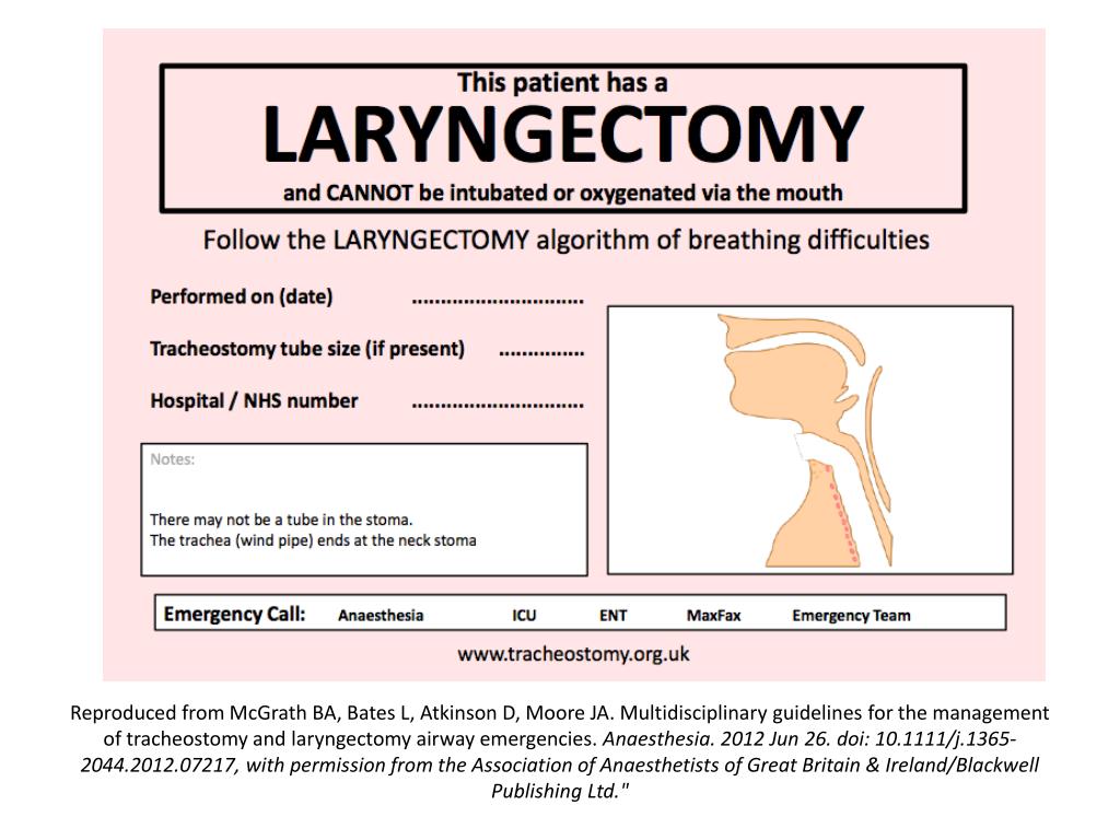 PPT - Laryngectomy & Tracheostomy Emergency Management & Patient ...