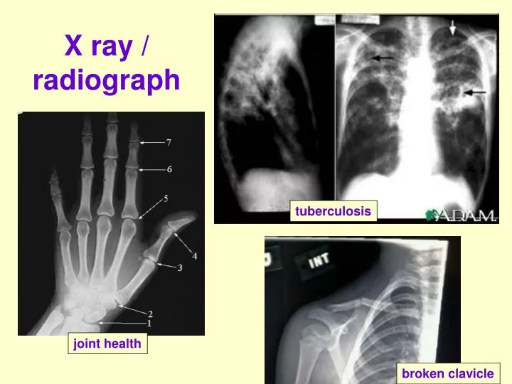 PPT - X ray / radiograph PowerPoint Presentation, free download - ID ...