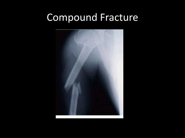 PPT - THE SKELETAL SYSTEM PowerPoint Presentation - ID:2694645
