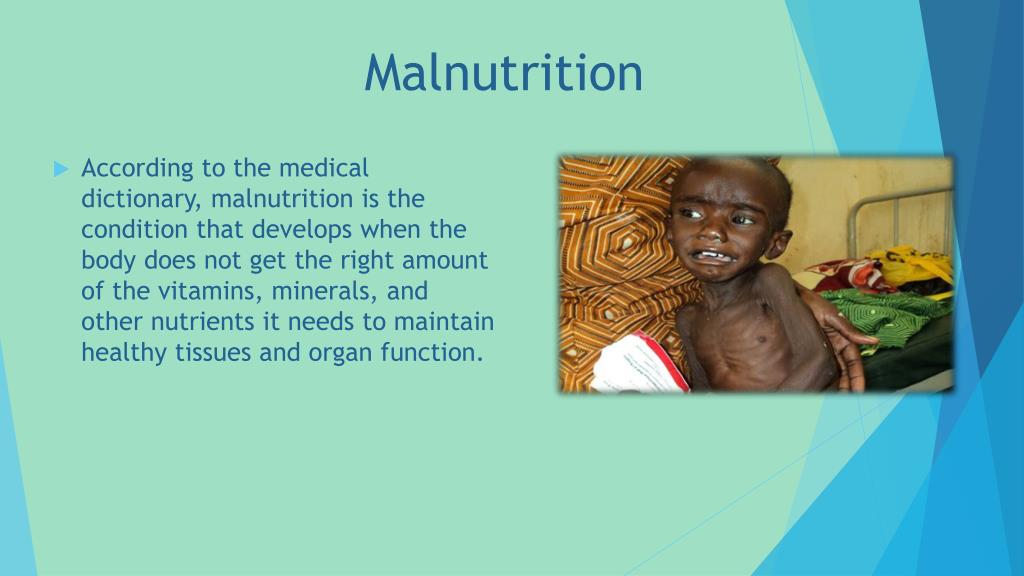 PPT - Poverty & Malnutrition PowerPoint Presentation, free download ...