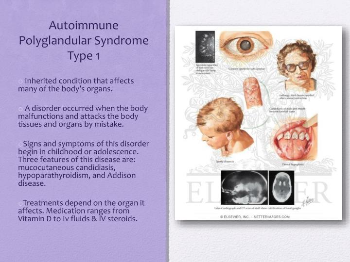 PPT - IMMUNE SYSTEM PowerPoint Presentation - ID:2696498