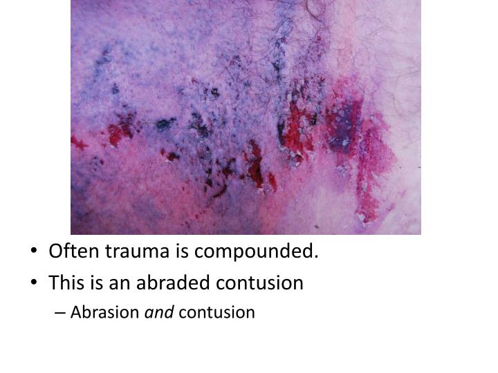 PPT - Unit 7: The Body PowerPoint Presentation - ID:2697847