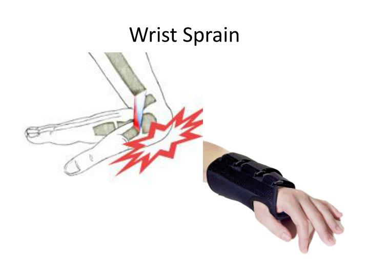 PPT - Common Wrist, Hand, & Finger Injuries PowerPoint Presentation ...