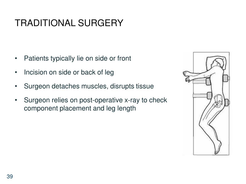 PPT - Treatment Options for your Hip Pain PowerPoint Presentation, free ...